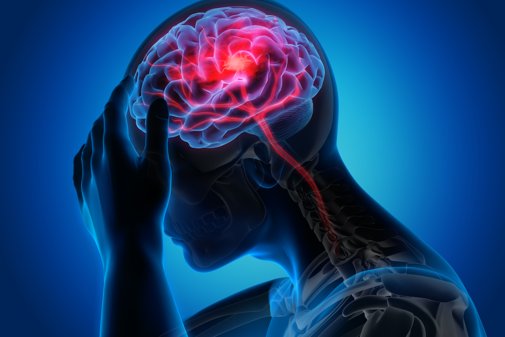 Memory and Attention Loss after a Traumatic Brain Injury | Northwest ...